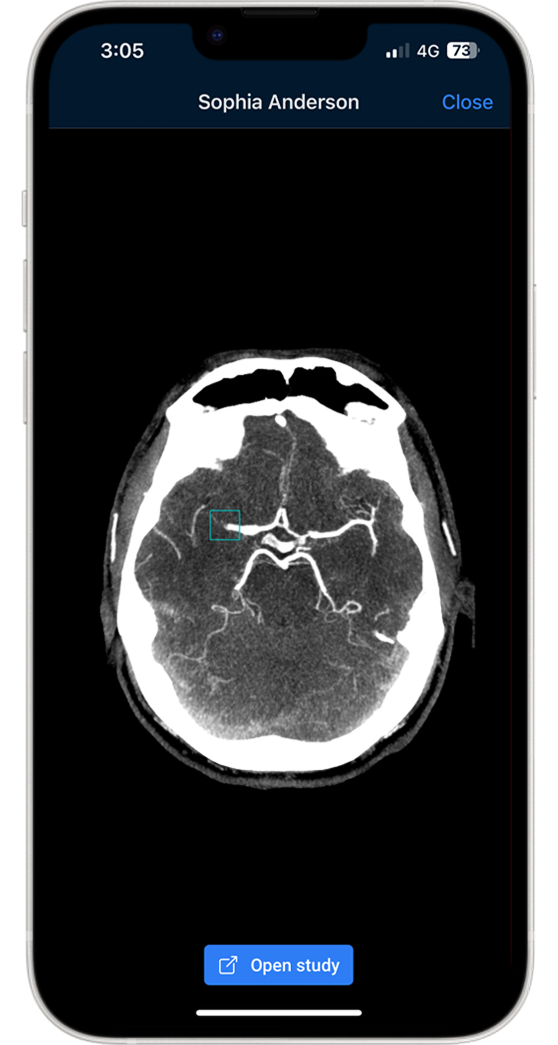 Nicolab – AI-Powered Stroke Workflow & Emergency Care Platform